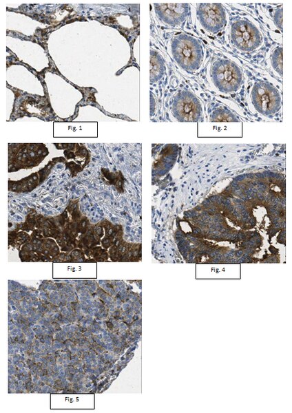 Anti-CEACAM6 Antibody, clone 1H7-4B | MABT323